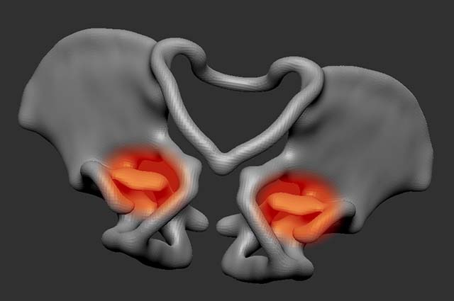 BUG: Remeshing Artifacts - ZBrushCentral